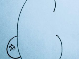 kyste du rein | www.docteurgrima.com